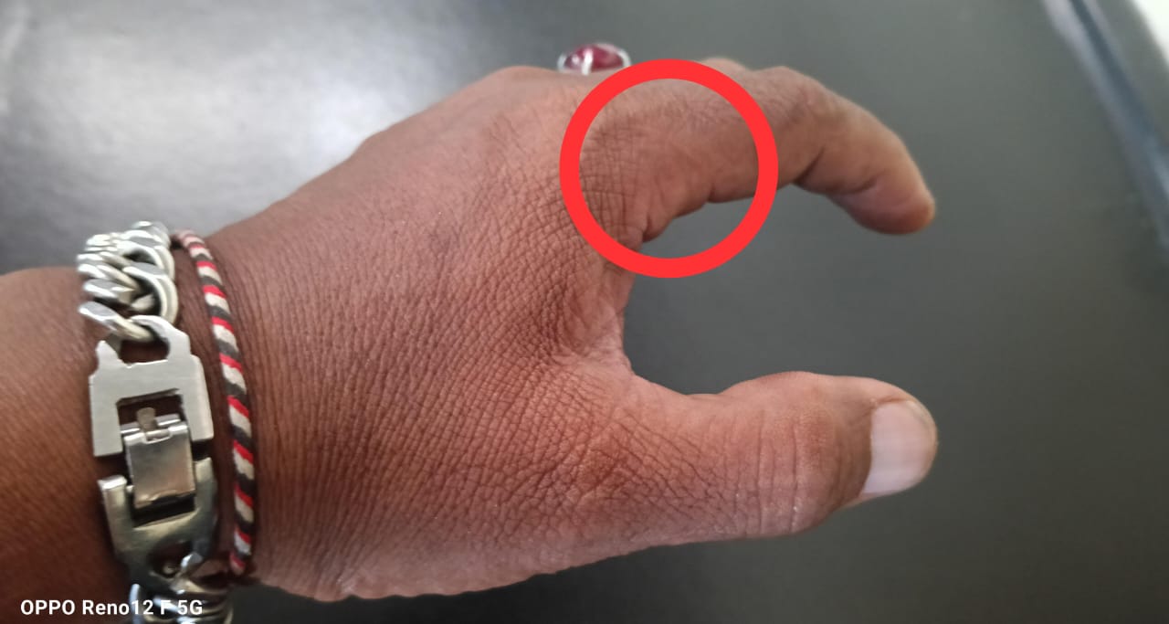 Tanda Sayatan di Jari Telunjuk kiri Pada Malam 1 Syuro Penuh Makna!